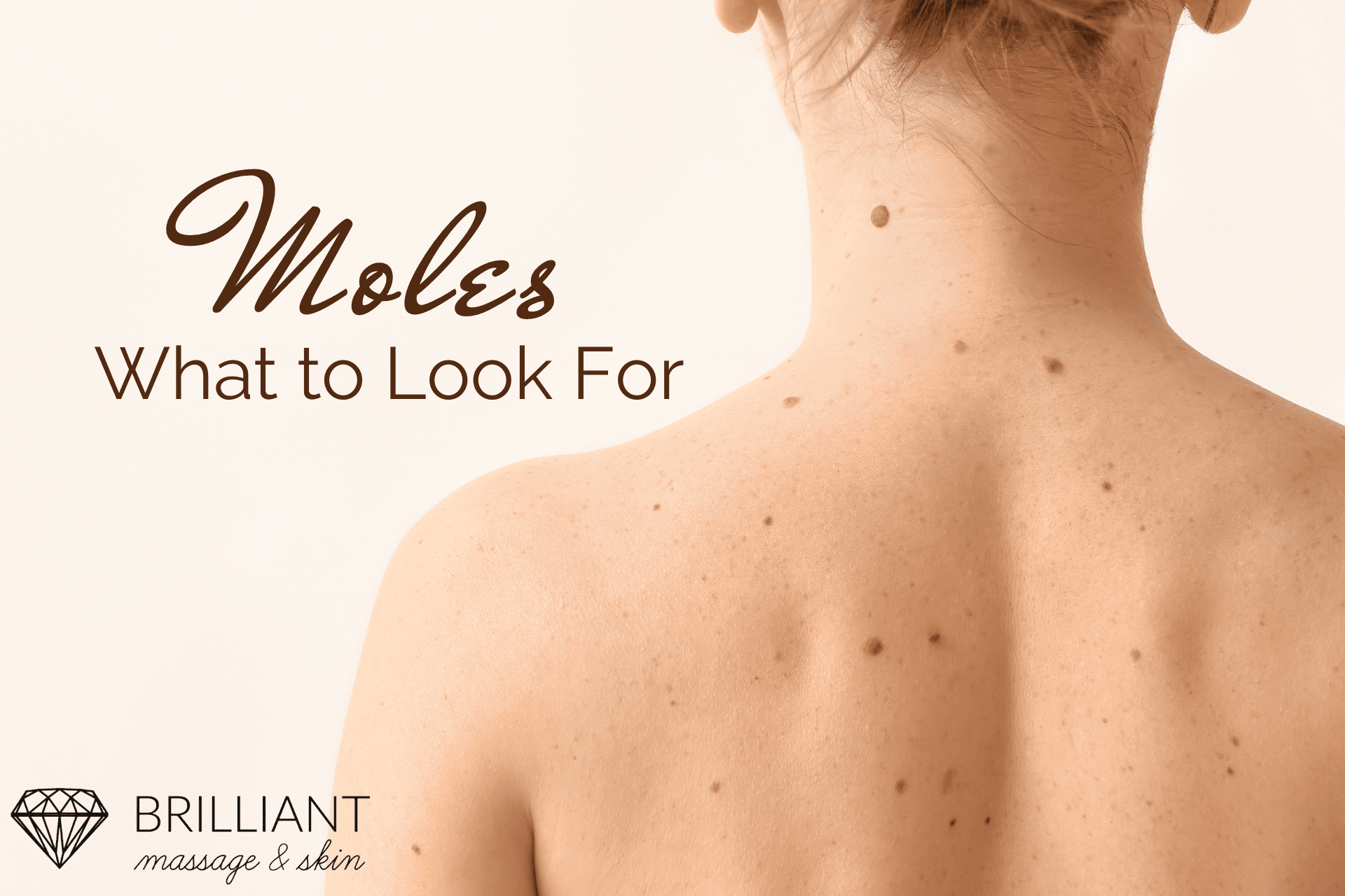 Moles – What to Look For - Brilliant Massage & Skin