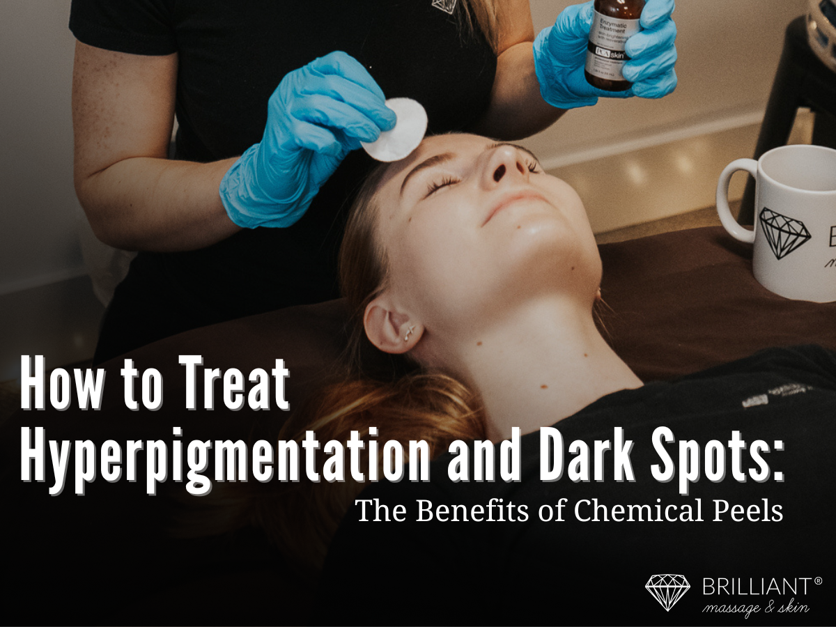 How to Treat Hyperpigmentation and Dark Spots: The Benefits of Chemical ...